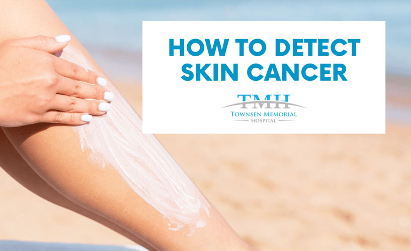 UV Awareness Month: How To Detect Skin Cancer